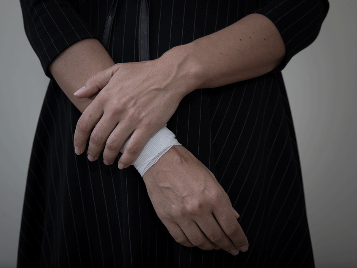 Scarred Wrists From Cutting