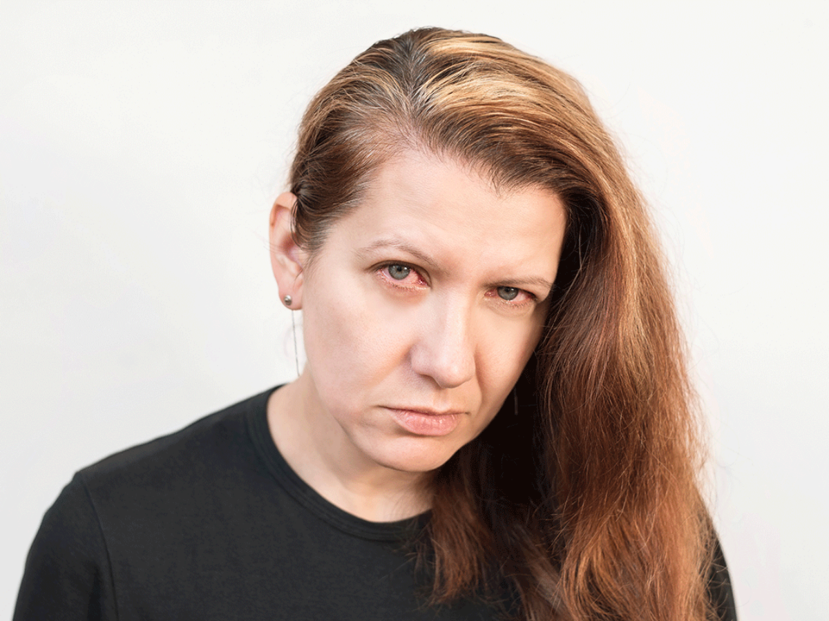 Bloodshot Eyes Alcohol